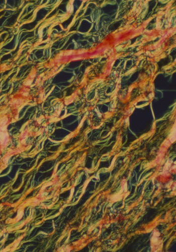 Identifying Collagen Fiber Types I and III High Color Rendering LED ...