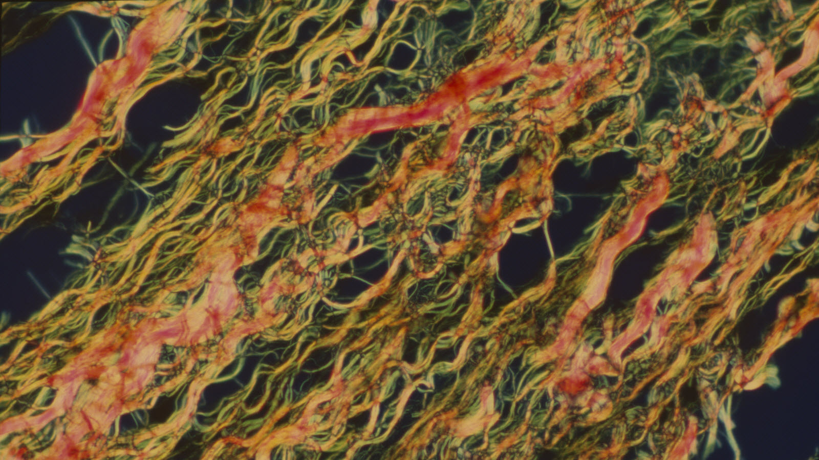 Identifying Collagen Fiber Types I and III High Color Rendering LED ...